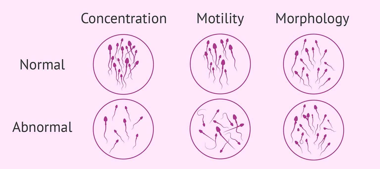 Semen Analysis | Dr. Biplab Deb