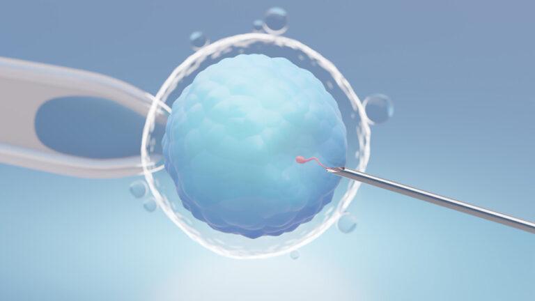Egg Retrieval in IVF: Pain, Anesthesia & Recovery Timeline Explained